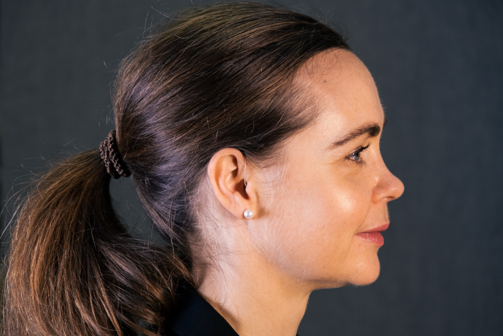 ReSound ONE Hearing Aids - Features & Benefits